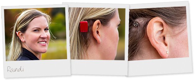 Adhear | NepočujúceDieťa.sk - porucha sluchu, rozvoj nepočujúcich detí